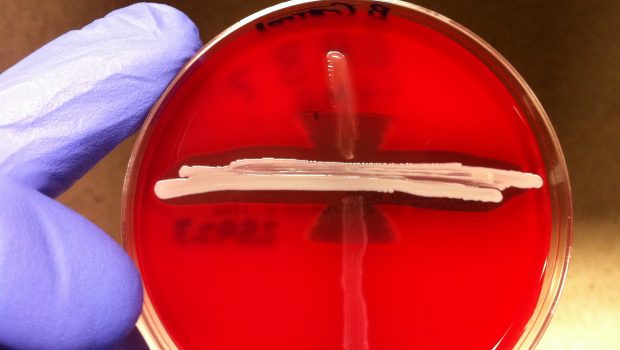 Κινδύνους από το strep-test εκτός ιατρείων δείχνουν οι εργαστηριακοί ...