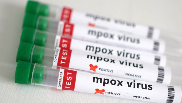 Mpox: Στο στέλεχος της επιδημίας στην Αφρική ανήκει το πρώτο κρούσμα mpox στην Ταϊλάνδη | in.gr